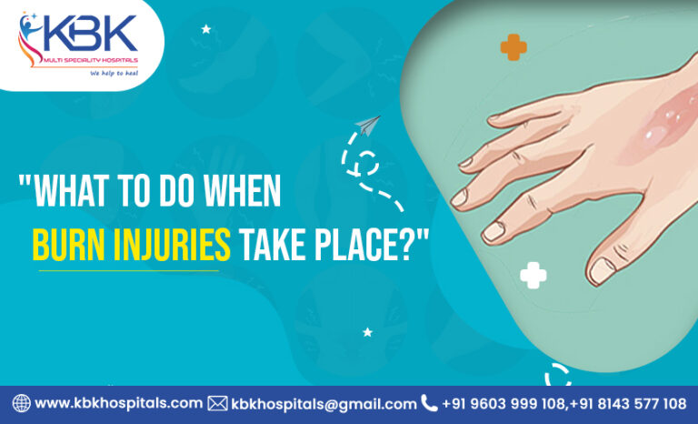 What to do when burn injuries take place? How to care for Burns.