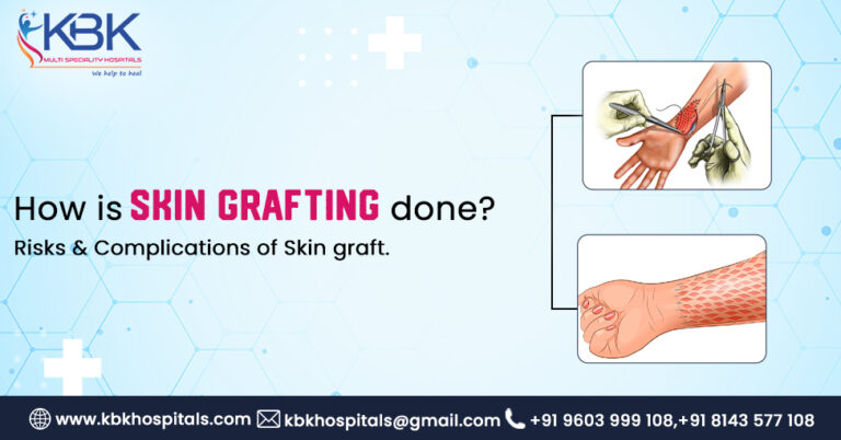 How is Skin grafting is done? it's risks & complications of skin graft.