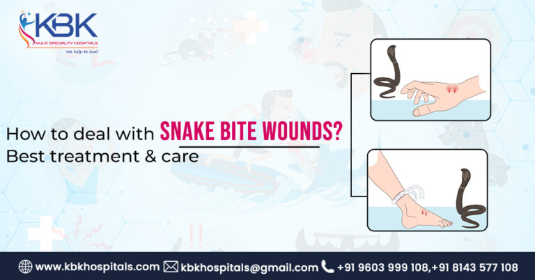 How to deal with Snake bite wounds ? Best treatment & care.