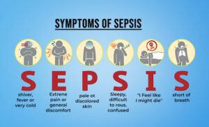 Do you know what Sepsis is? Best Treatment & Prevention ways.