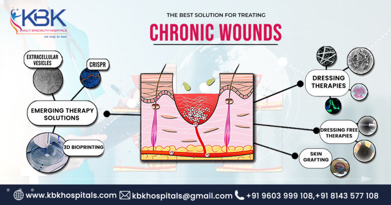 The Best Solution for treating Chronic wounds.