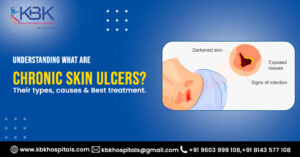 Understanding what is a Chronic skin ulcer? Best treatment & cure