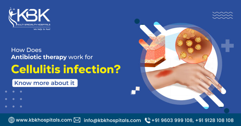 Do you know what Sepsis is? Best Treatment & Prevention ways.