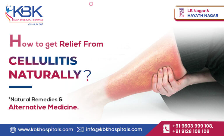 Cellulitis : What are it's Natural Remedies & Alternative Medicine?