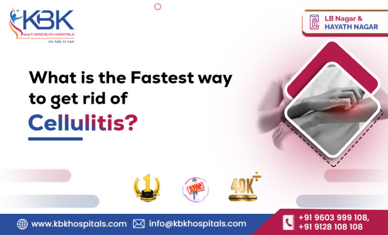 Fastest way to get rid of Cellulitis with Advanced Woundcare.