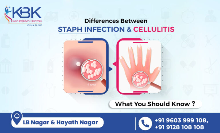 Staph Infection and Cellulitis : Know the Differences.