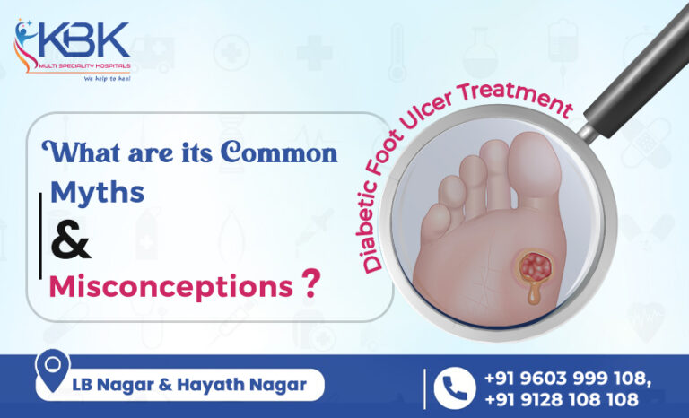 Diabetic Foot Ulcer Treatment Common Myths And Misconceptions 8504