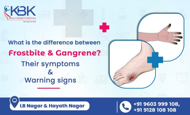 What is Difference Between Frostbite and Gangrene? Symptoms