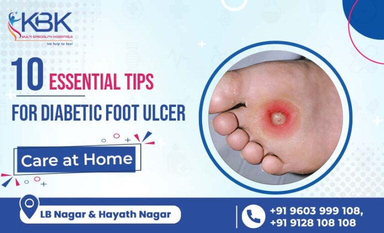10 Essential Tips for Diabetic Foot Ulcer Care at Home