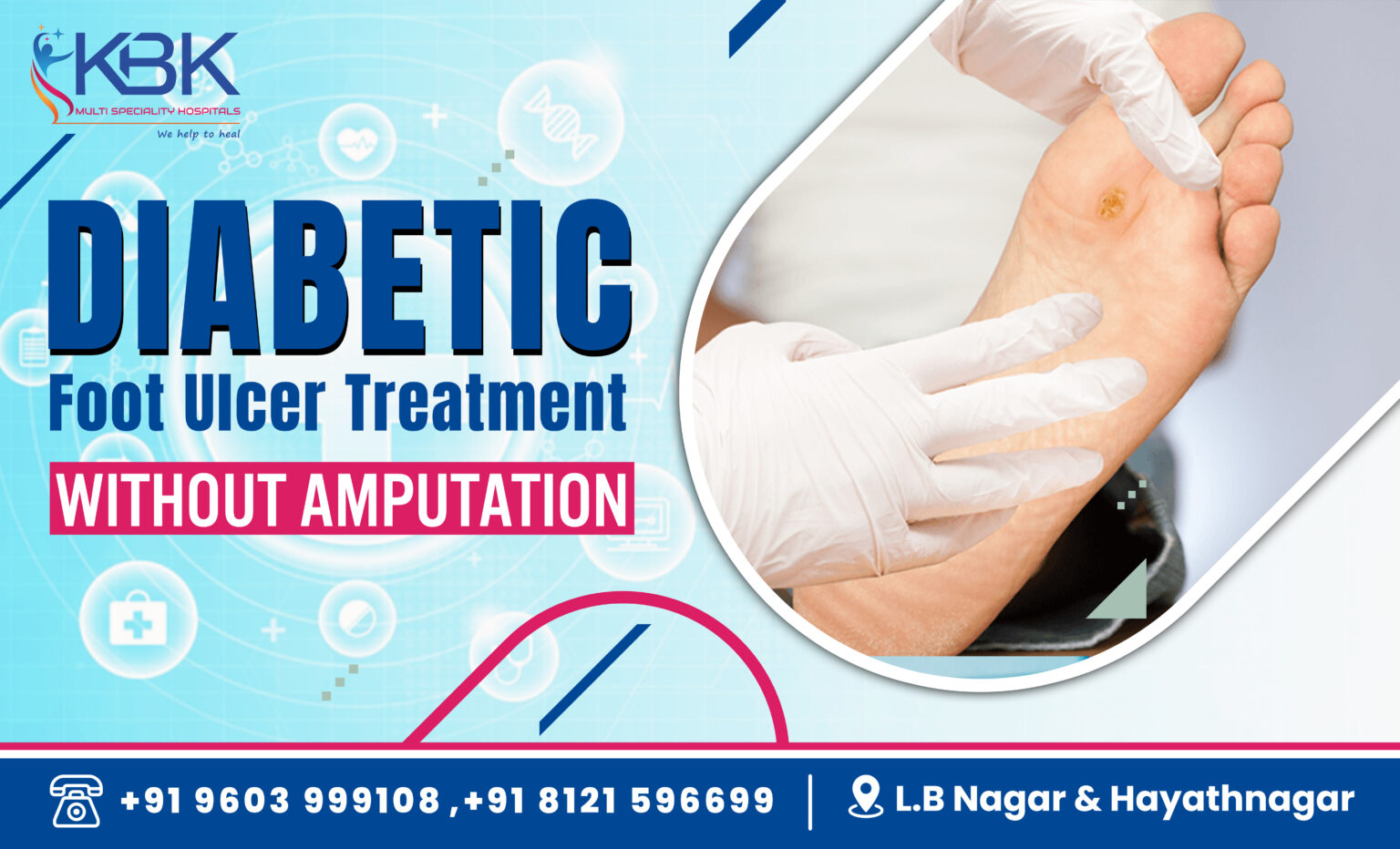 Offloading in Diabetic Foot Ulcer Treatment Explained