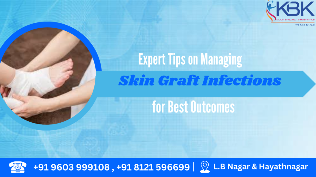 Expert Tips on Managing Skin Graft Infections for Best Outcomes