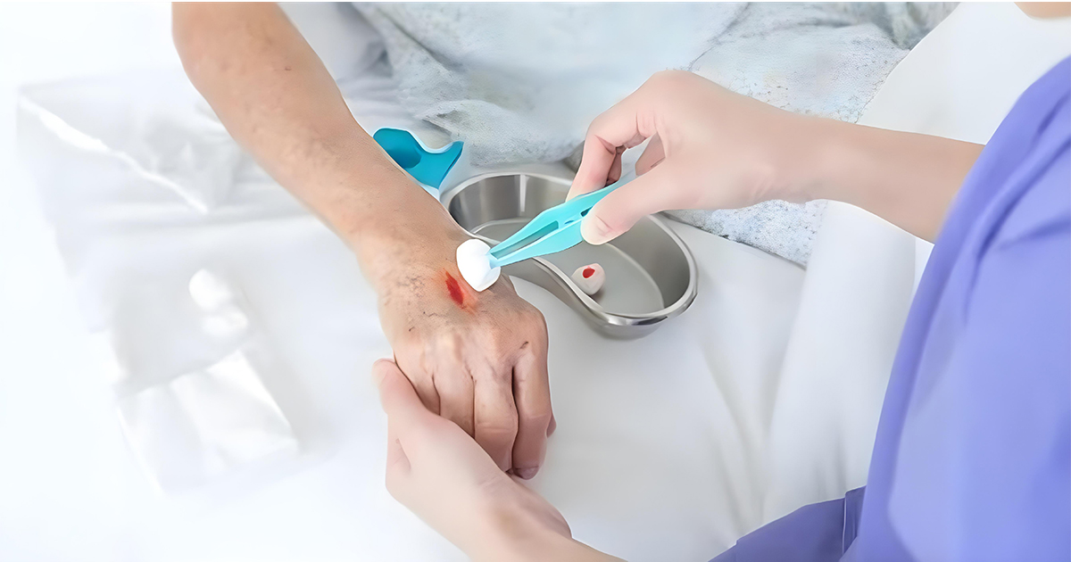 Septic Wounds : Causes, Symptoms, and Treatment