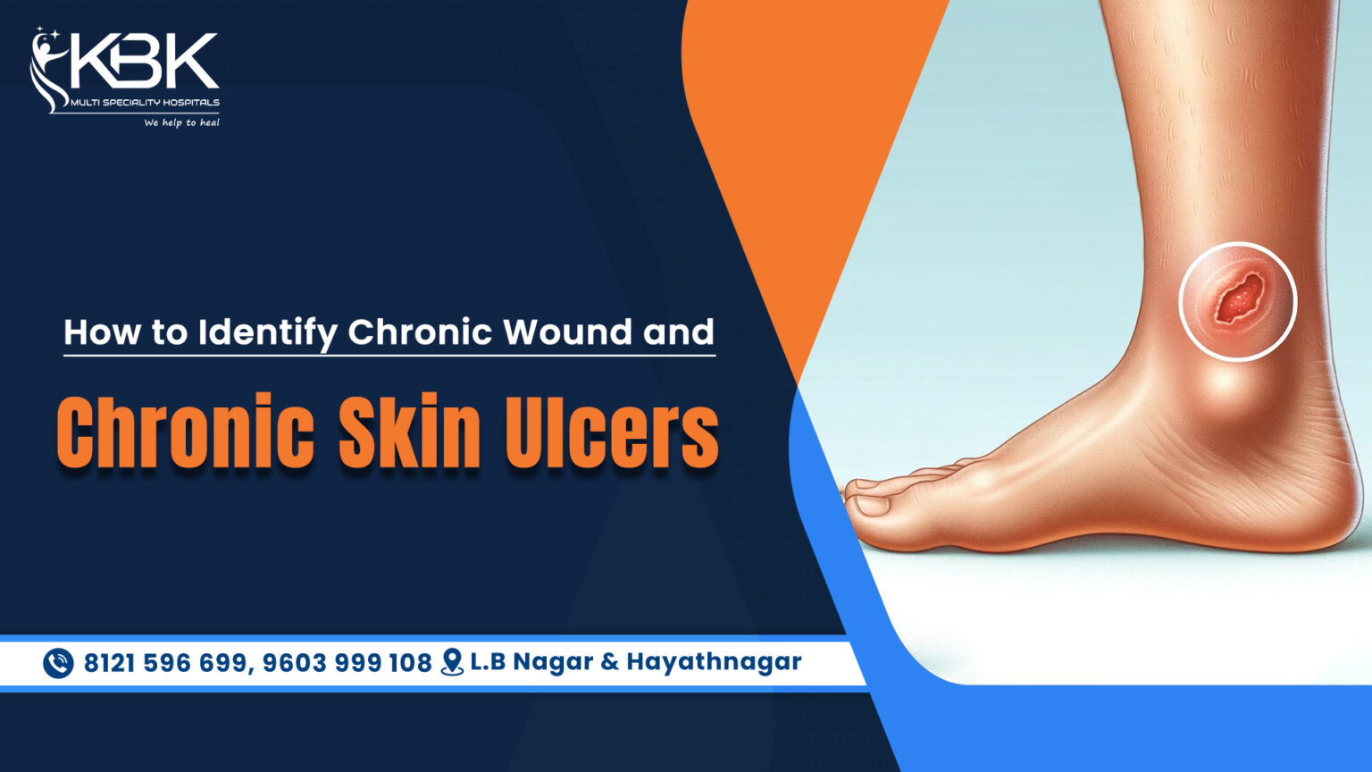 The Best Solution for treating Chronic wounds.