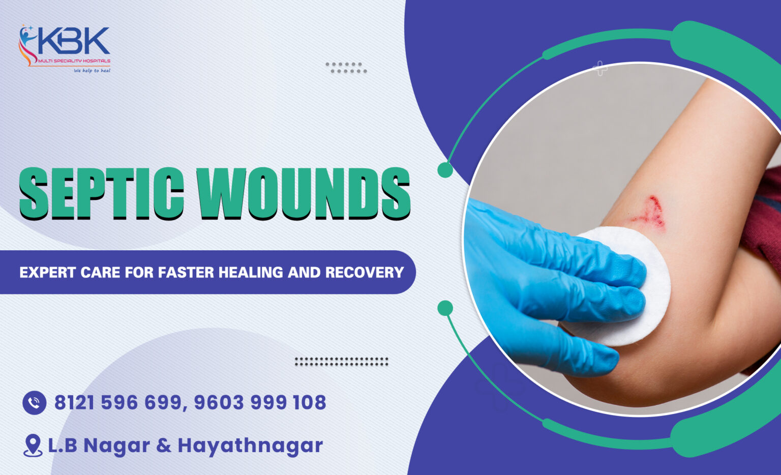 Septic Wounds : Causes, Symptoms, and Treatment