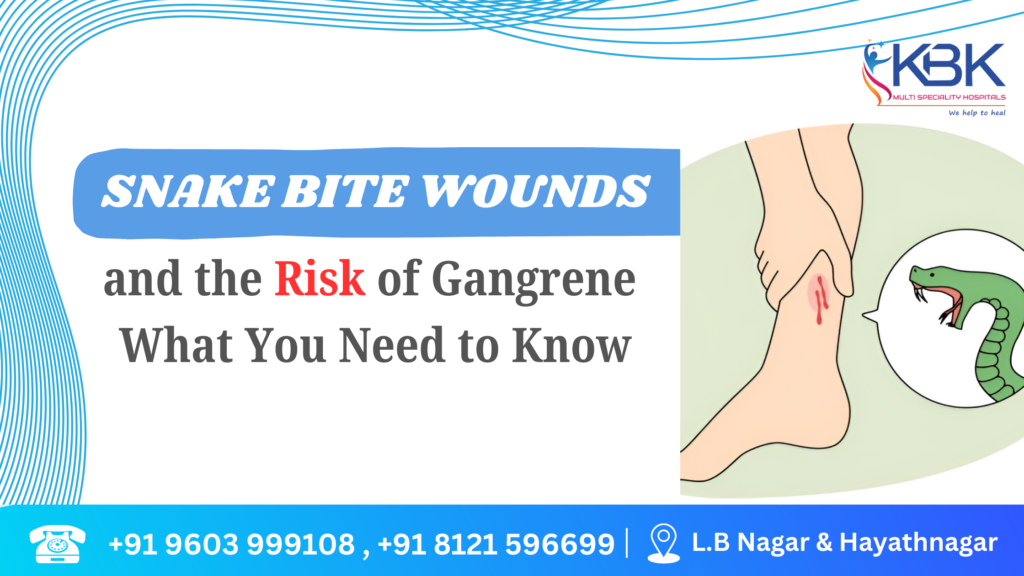 Snake bite wounds: Recognize the risks and prevent gangrene