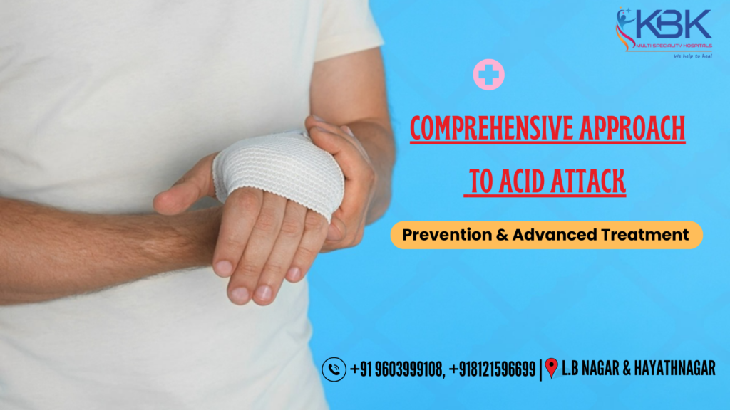 How to Treat Acid Attacks? Explore Safe Remedies