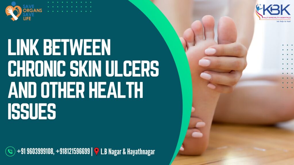Link Between Chronic Skin Ulcers and Other Health Issues