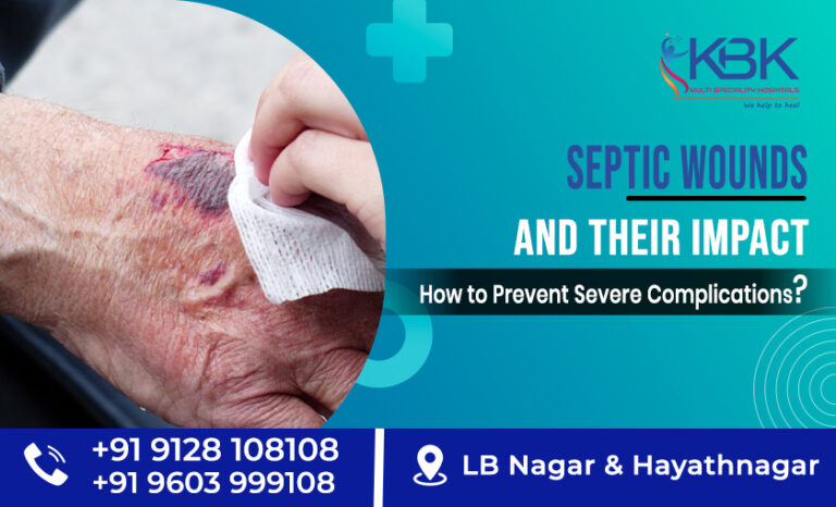 Septic Wound: Prevent Severe Complications with Early Care