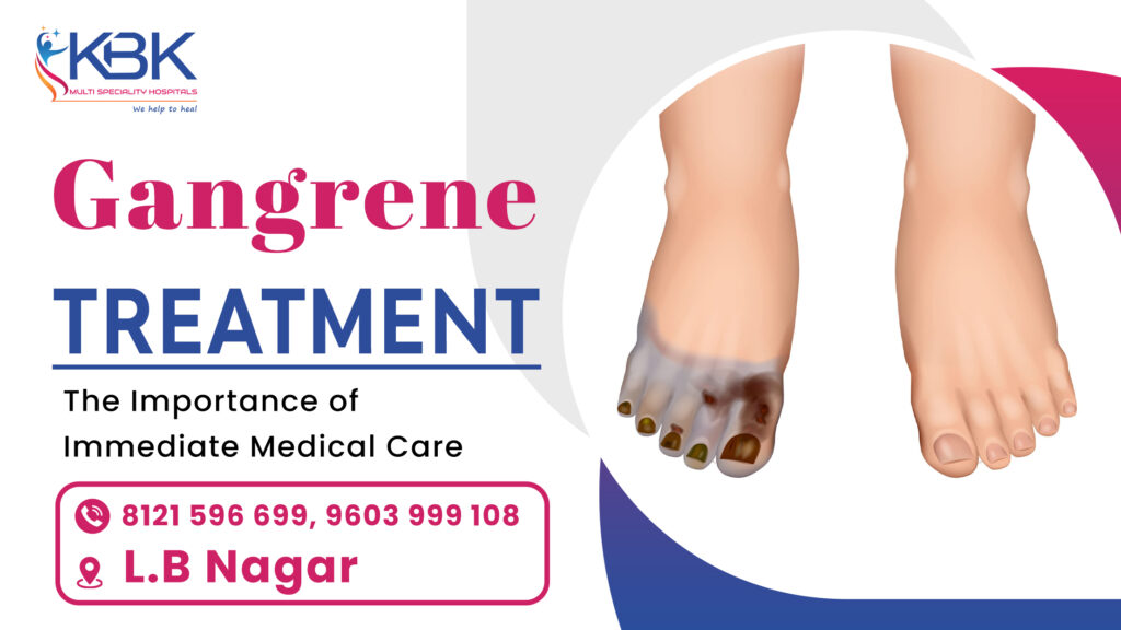 Gangrene Treatment: The Importance of Immediate Medical Care