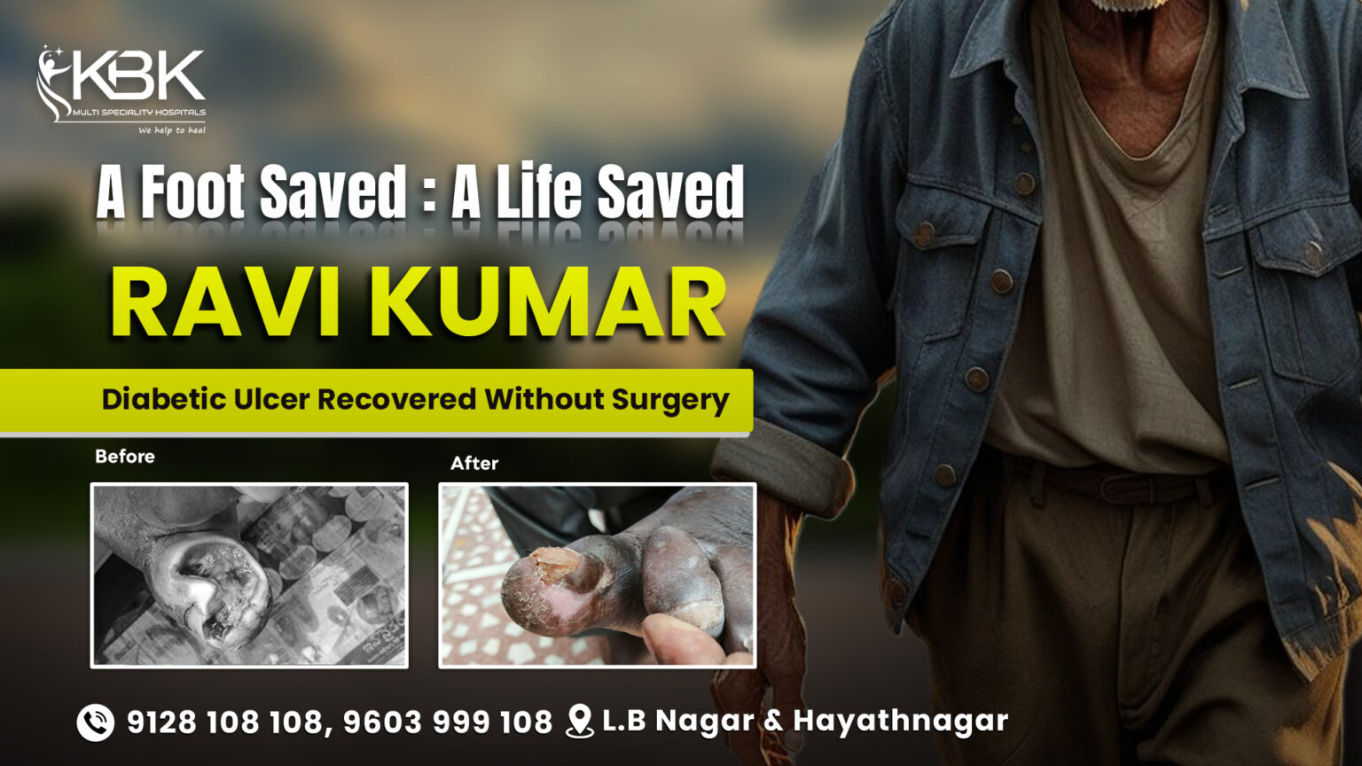 Understanding what is a Chronic skin ulcer? Best treatment & cure