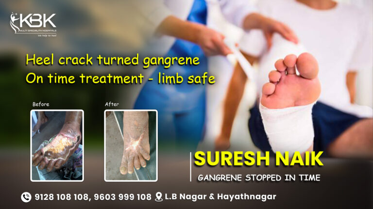 Septic Wound: Prevent Severe Complications with Early Care