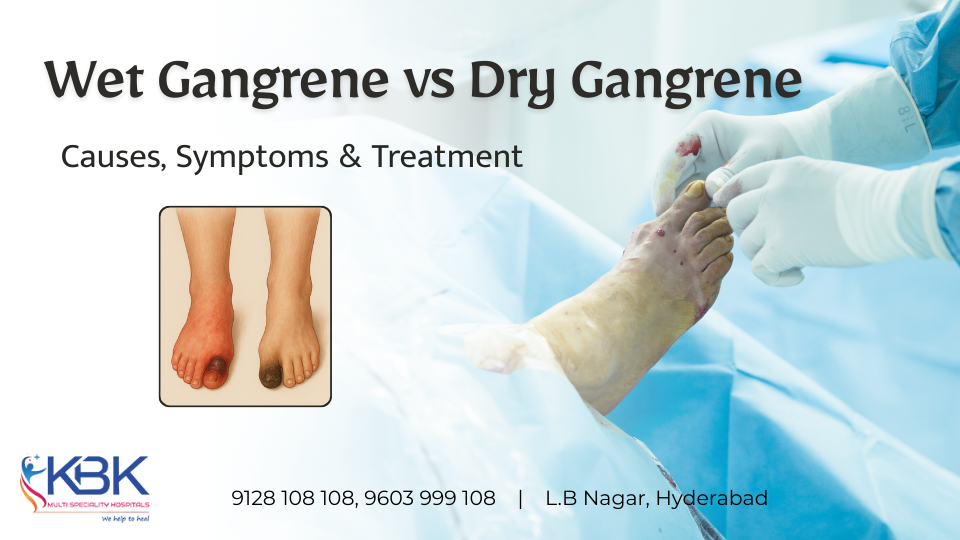 Wet Gangrene: Causes, Symptoms & Best Treatment
