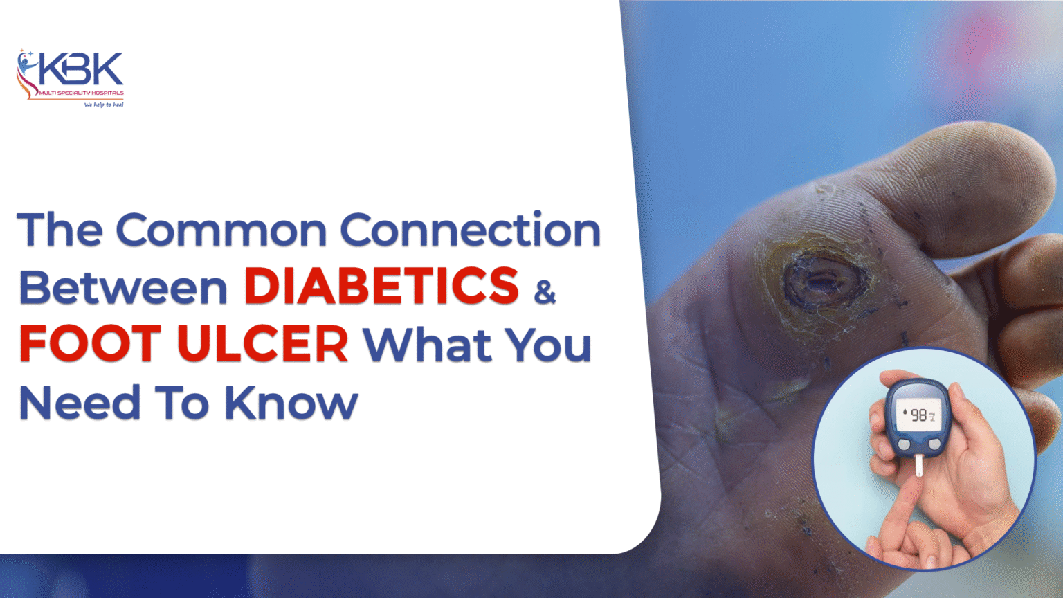 Diabetic Foot Ulcers & Diabetes Link Explained