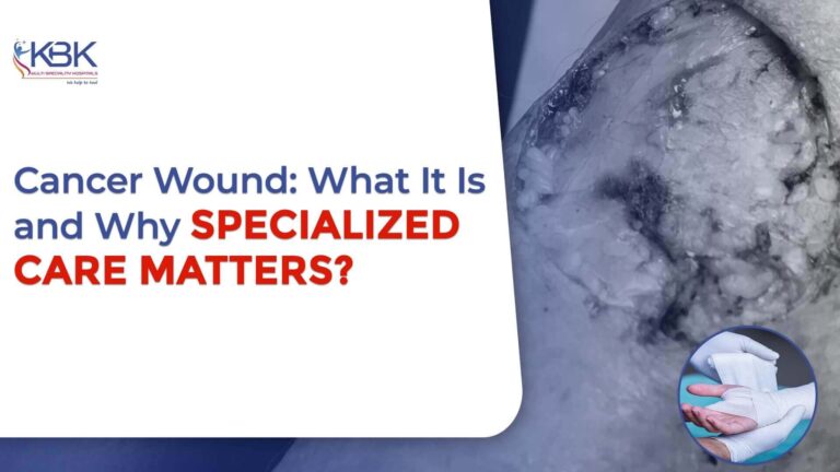 How to Treat Acid Attacks? Explore Safe Remedies