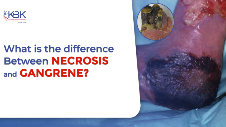 Cellulitis Symptoms : Early Warning Signs You Shouldn't Ignore