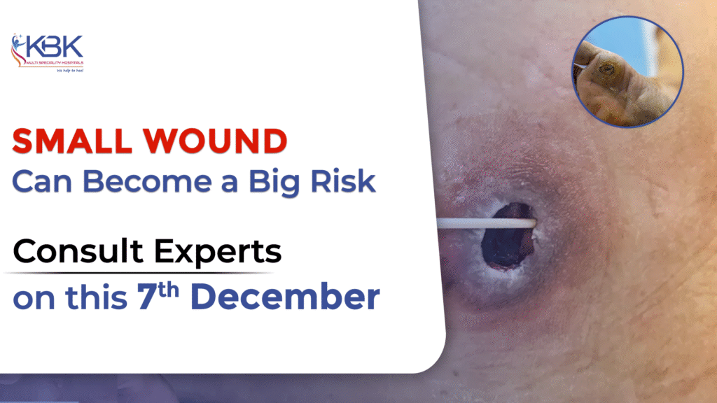 Septic Wound: Prevent Severe Complications with Early Care