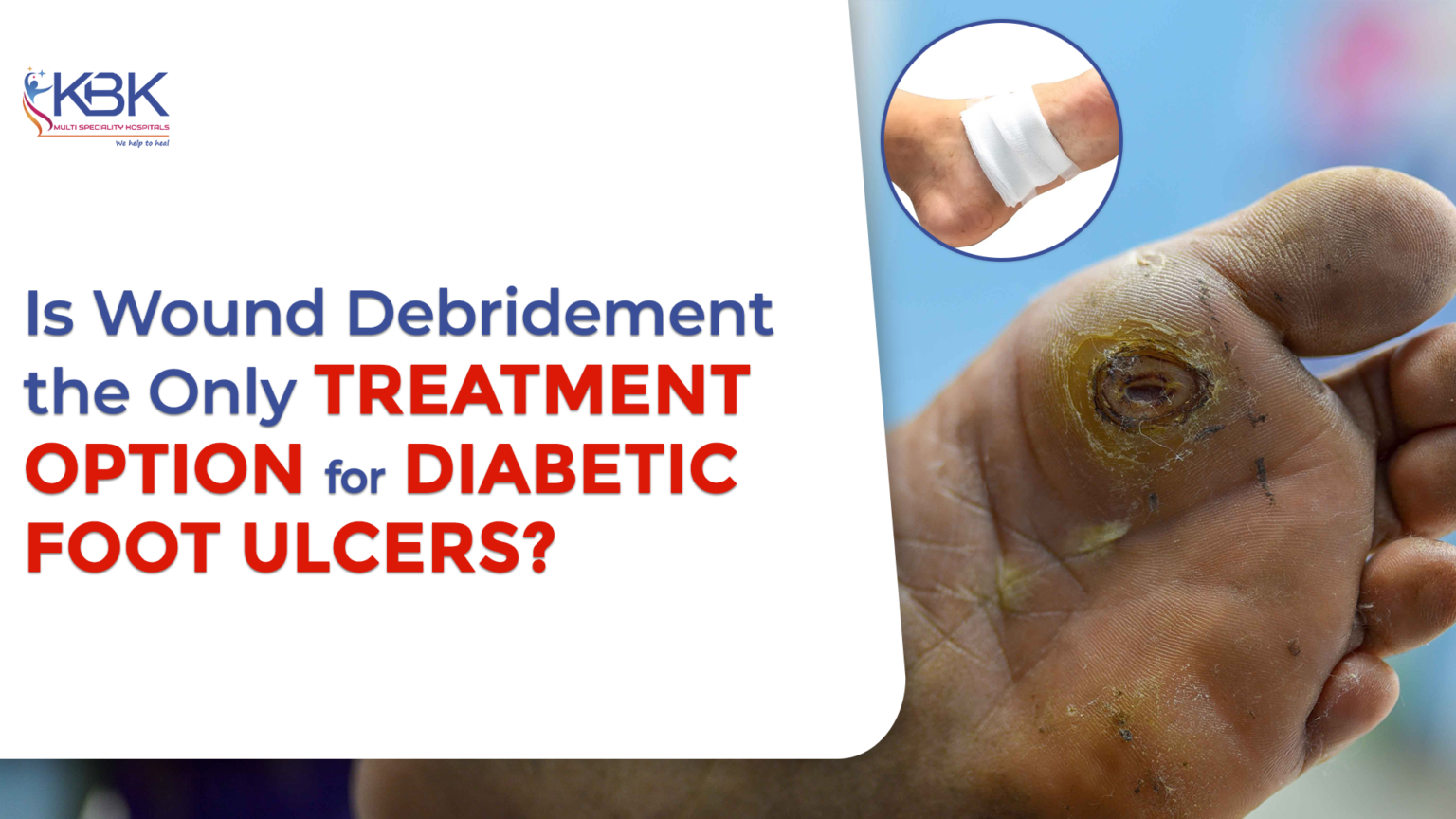 What is Difference Between Frostbite and Gangrene? Symptoms