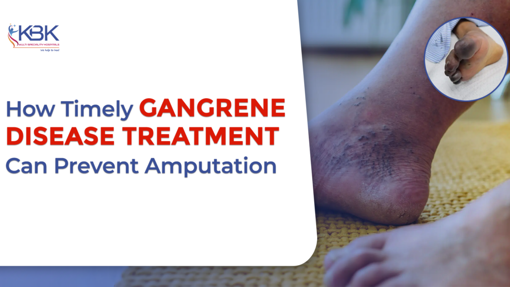 Gangrene Disease Treatment & Amputation Risk