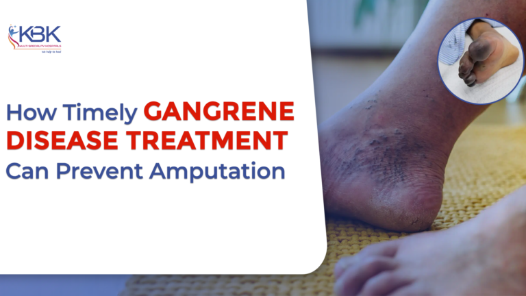 Gangrene Disease Treatment & Amputation Risk
