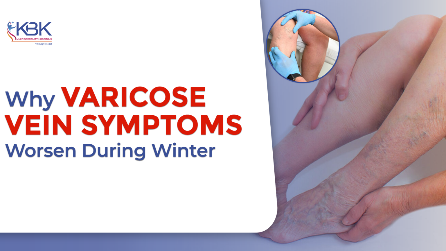 Varicose Vein Symptoms: Signs & Care Tips